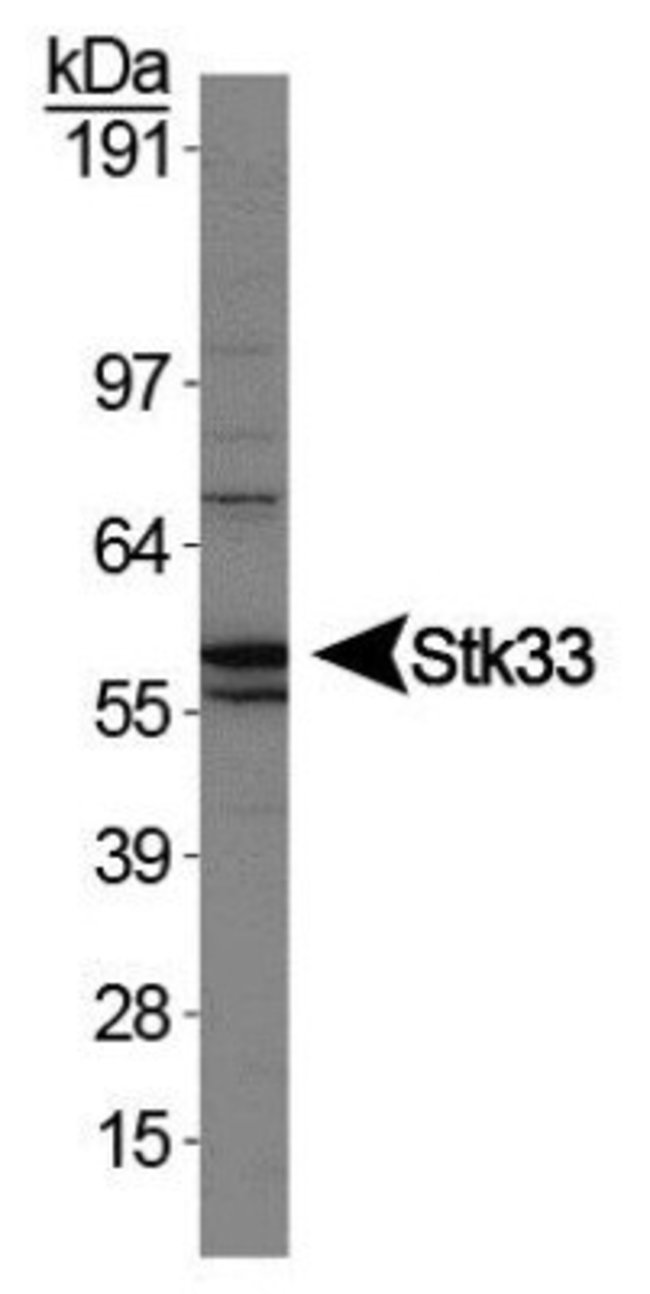 STK33 Polyclonal Antibody, Invitrogen 100 μL; Unconjugated:Anticuerpos ...