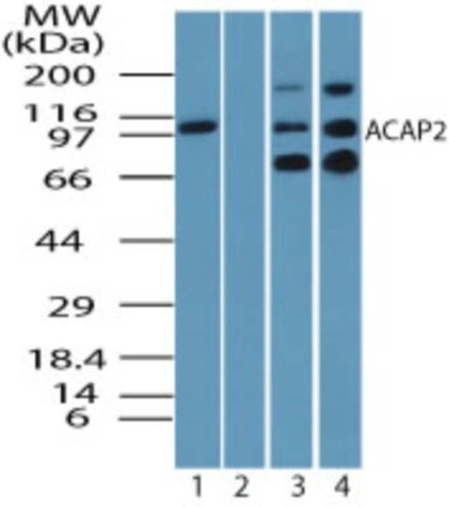 Invitrogen ACAP2 Polyclonal Antibody 100 μg; Unconjugated:Antibodies ...