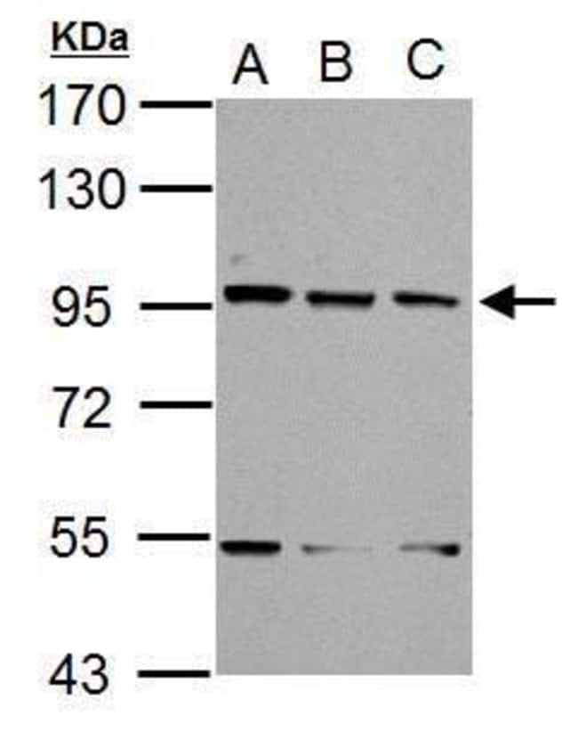 Invitrogen XAB2 Polyclonal Antibody 100 μL | Buy Online | Invitrogen ...