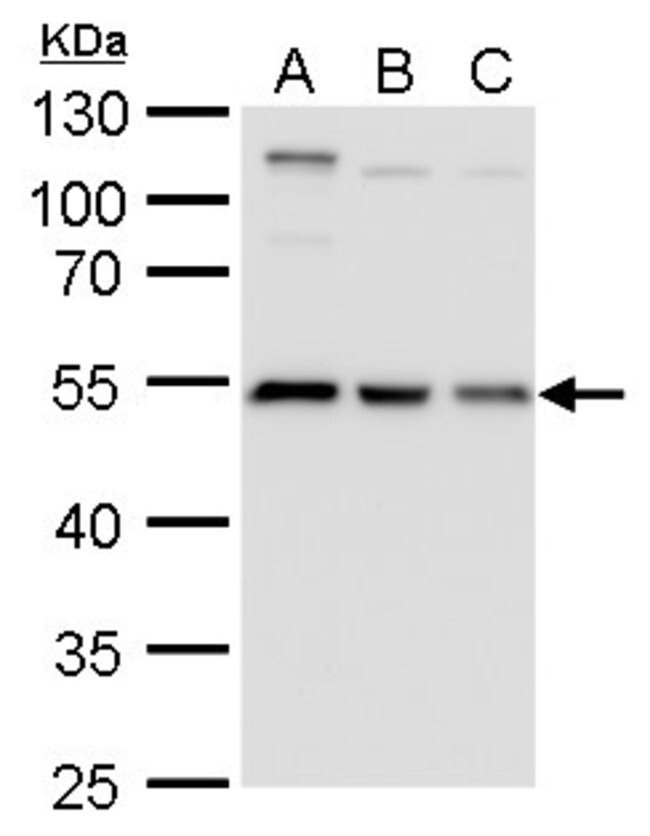 beta Tubulin 2 Polyclonal Antibody, Invitrogen™ 100 μL; Unconjugated ...