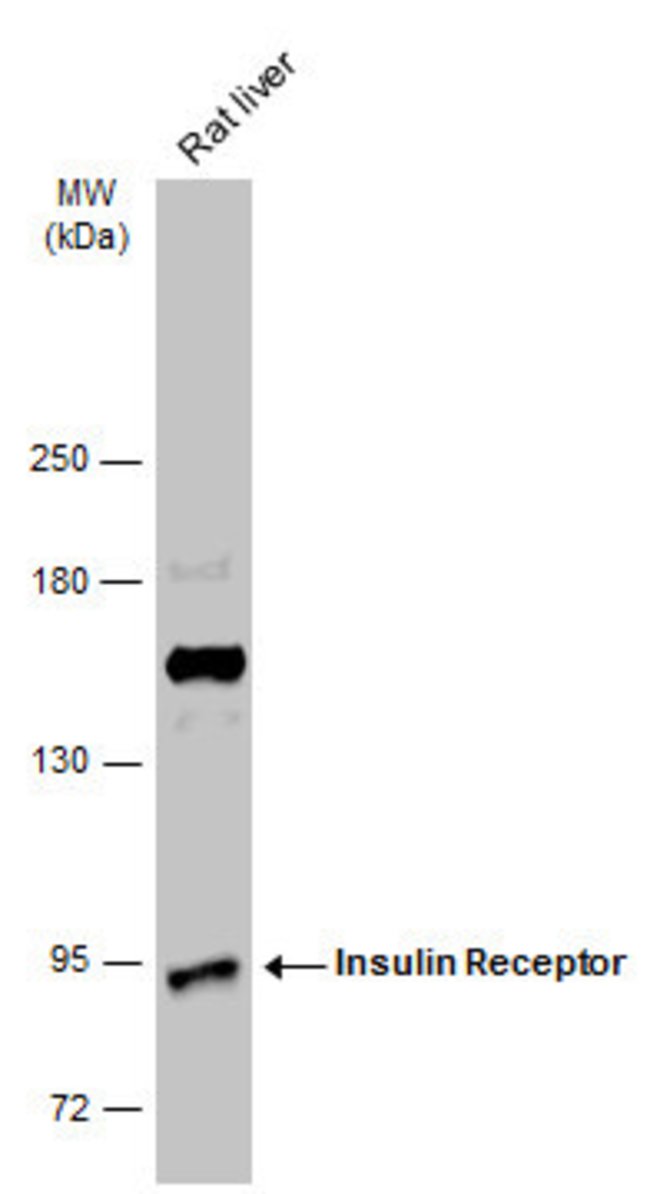 INSR Polyclonal Antibody, Invitrogen 100 μL; Unconjugated:Anticuerpos ...