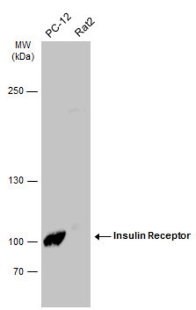 INSR Polyclonal Antibody, Invitrogen 100 μL; Unconjugated:Anticuerpos ...