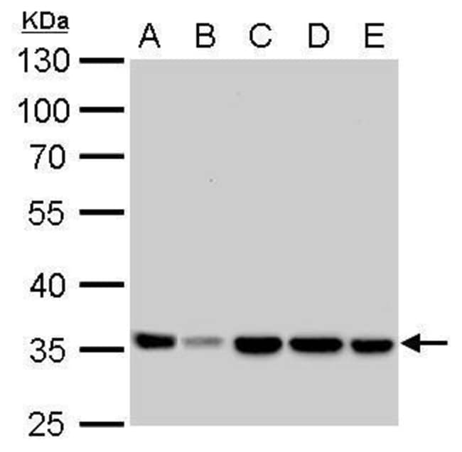 Invitrogen LDHA Polyclonal Antibody 100 μL; Unconjugated:Antibodies ...