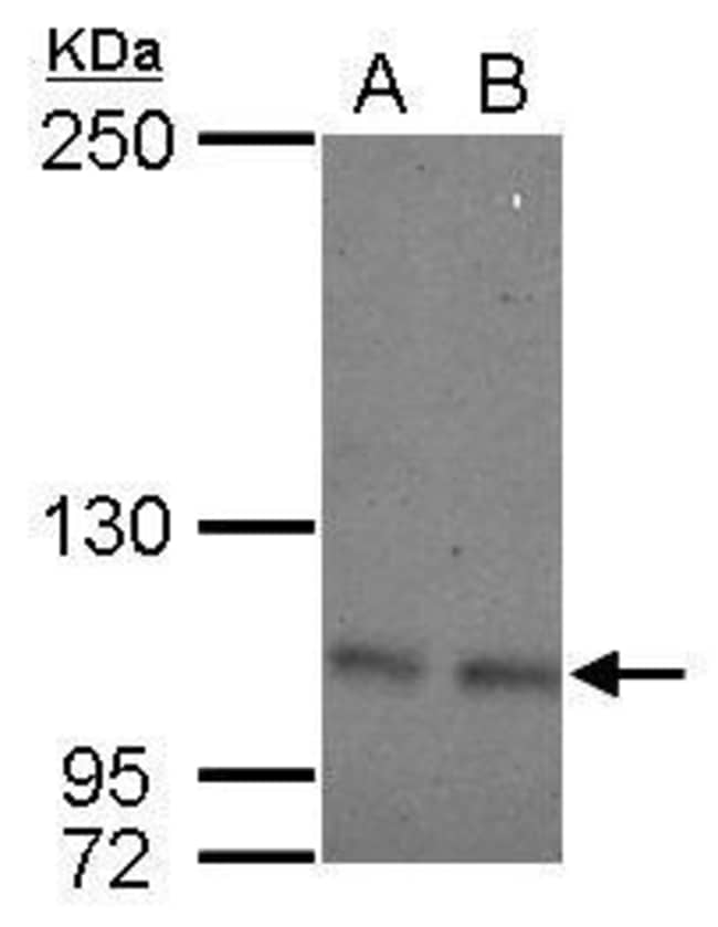 Invitrogen OCRL Polyclonal Antibody 100 μL; Unconjugated:Antibodies ...