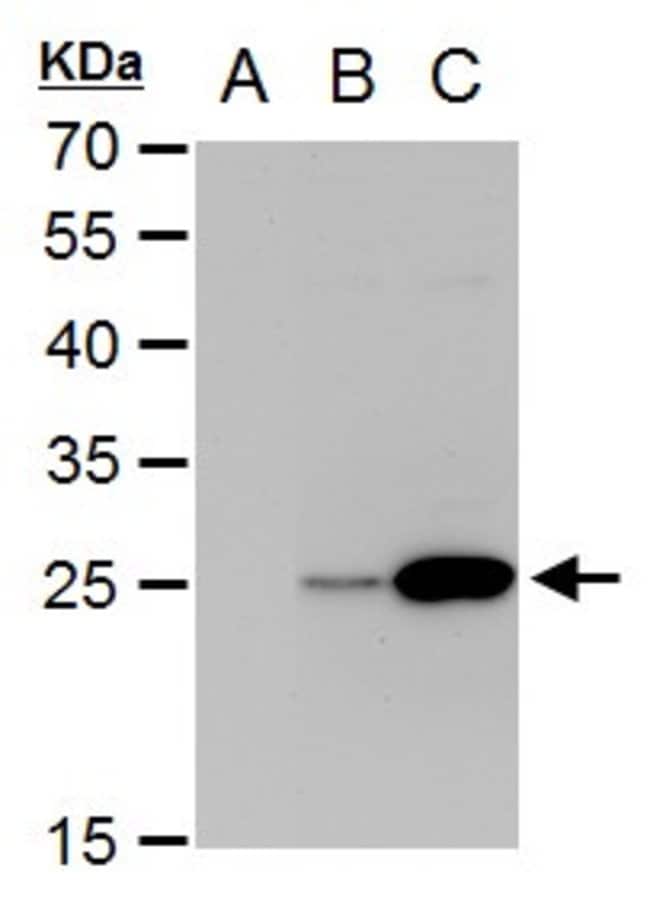 Invitrogen Dengue Virus Type 2 NS4B Polyclonal Antibody 100 μL ...