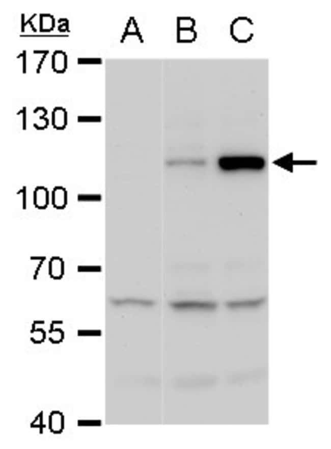 Invitrogen Dengue Virus Type 2 NS5 Polyclonal Antibody 100 μL ...