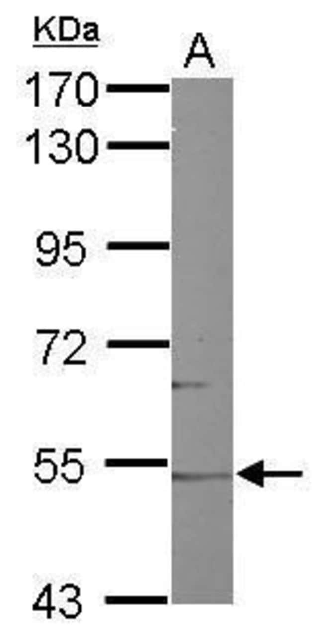 Invitrogen Cyp46a1 Polyclonal Antibody 100 μL; Unconjugated:Antibodies ...