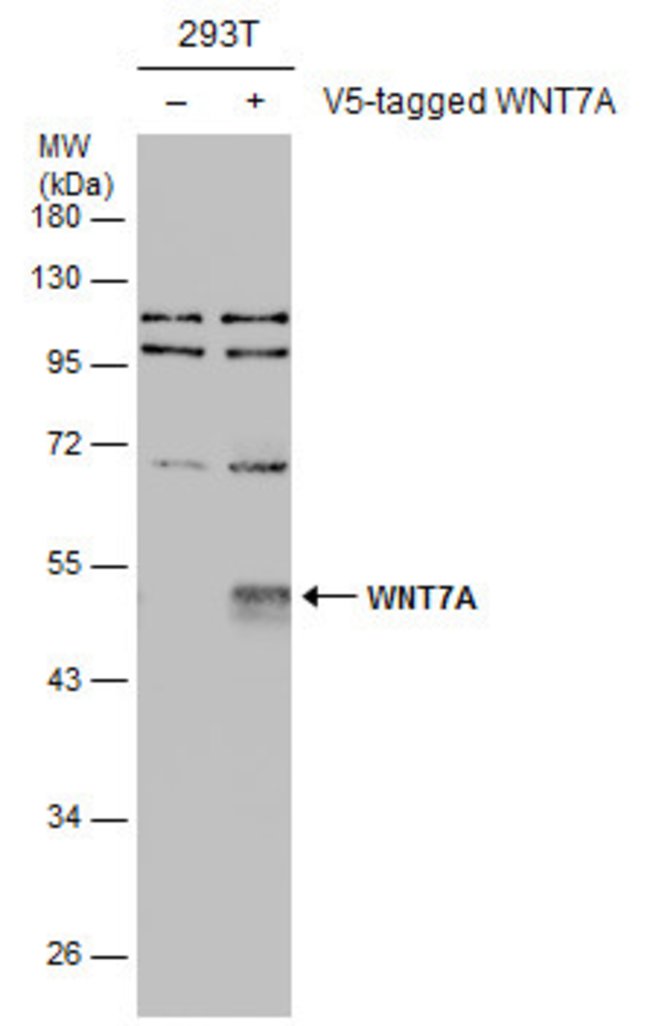 Invitrogen WNT7A Polyclonal Antibody 100 μL; Unconjugated:Antibodies ...