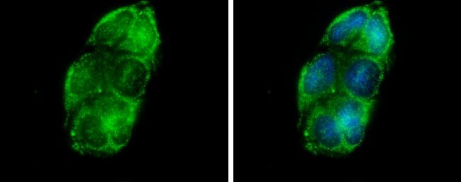 Glycerol kinase Polyclonal Antibody, Invitrogen 100 μL; Unconjugated ...