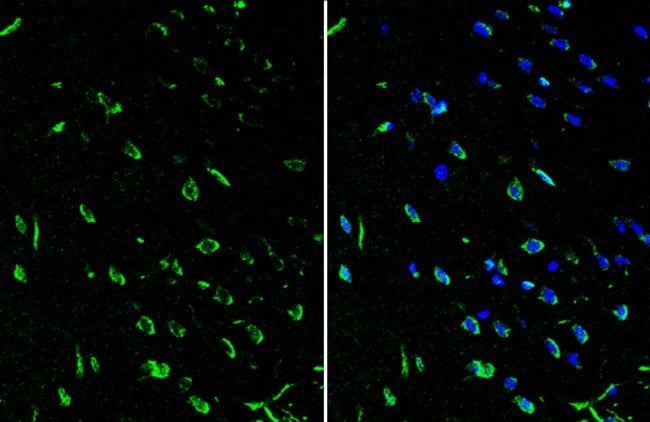 RORB Polyclonal Antibody, Invitrogen 100 μL; Unconjugated:Antibodies ...