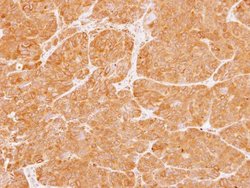 Invitrogen PKC zeta Polyclonal Antibody 100 μL; Unconjugated:Anticuerpos | Fisher Scientific
