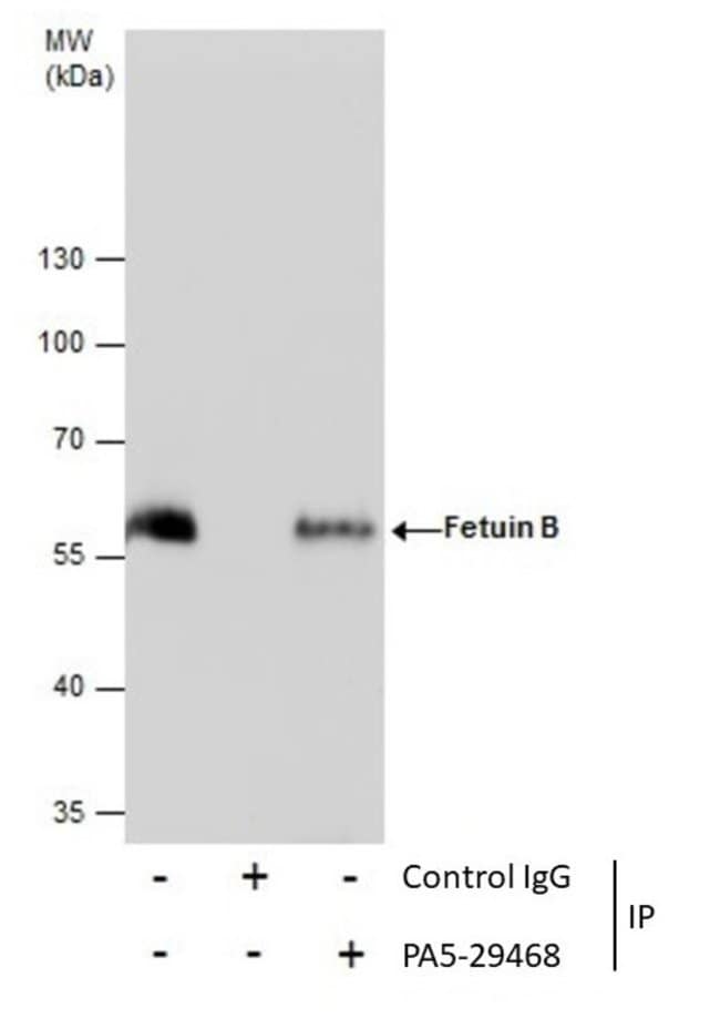 Fetuin B Polyclonal Antibody, Invitrogen 100 μL; Unconjugated ...