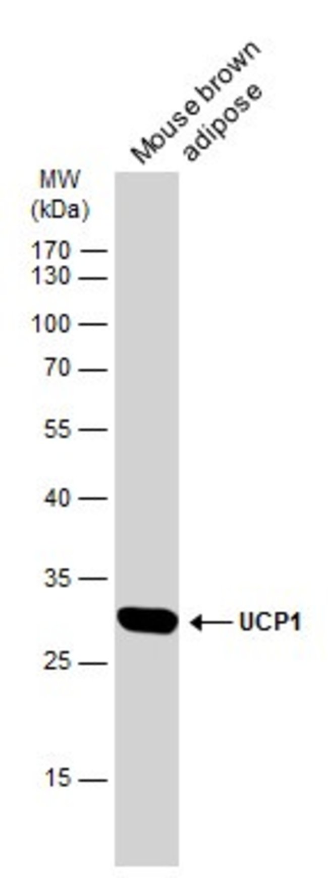 Invitrogen UCP1 Polyclonal Antibody 100 μL; Unconjugated:Antibodies ...