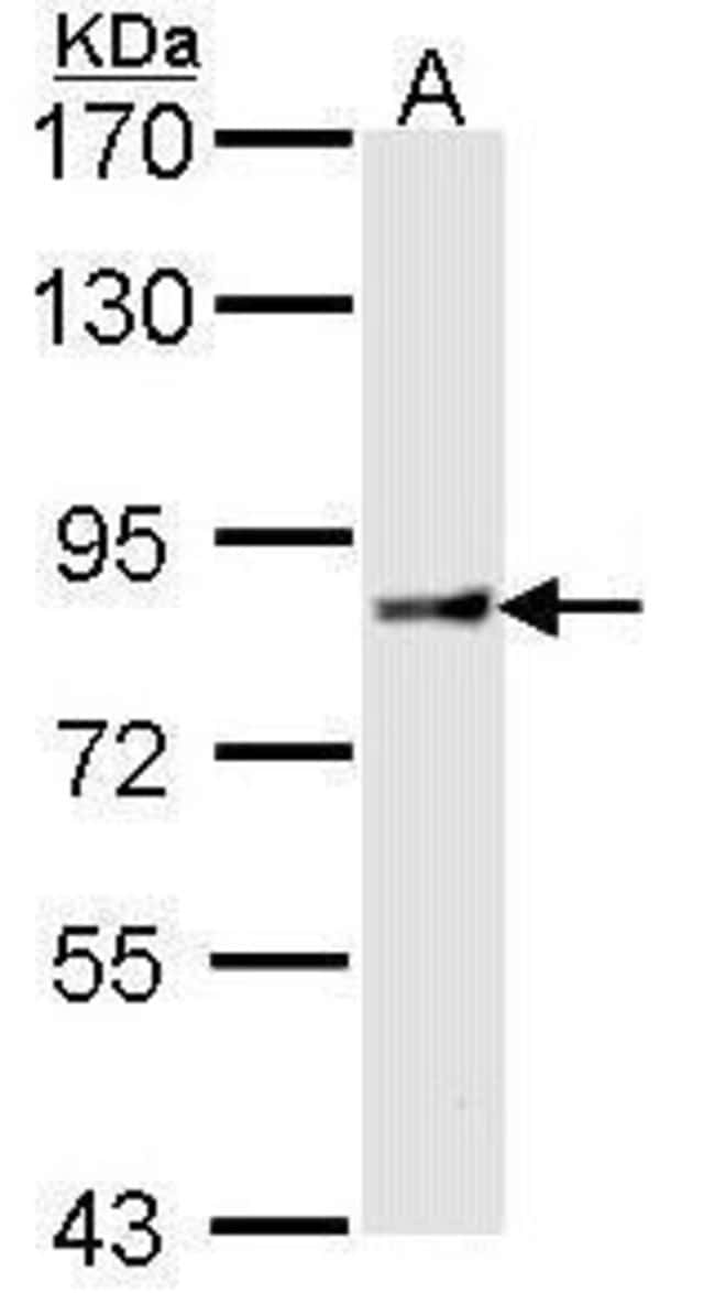 Cullin 4A Polyclonal Antibody, Invitrogen™ 100 μL; Unconjugated ...