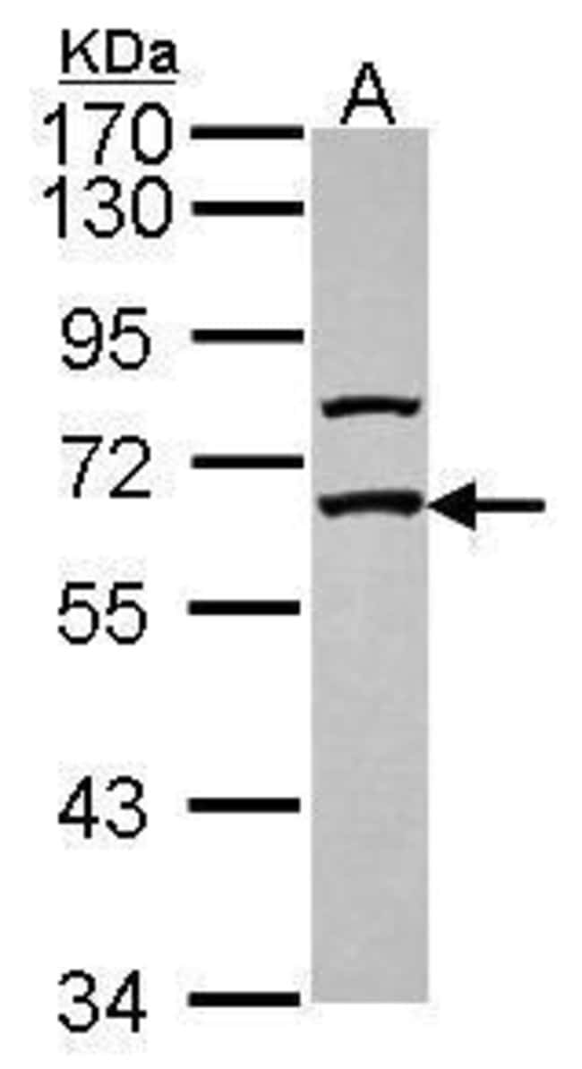 GABRE Polyclonal Antibody, Invitrogen 100 μL; Unconjugated:Anticorps ...