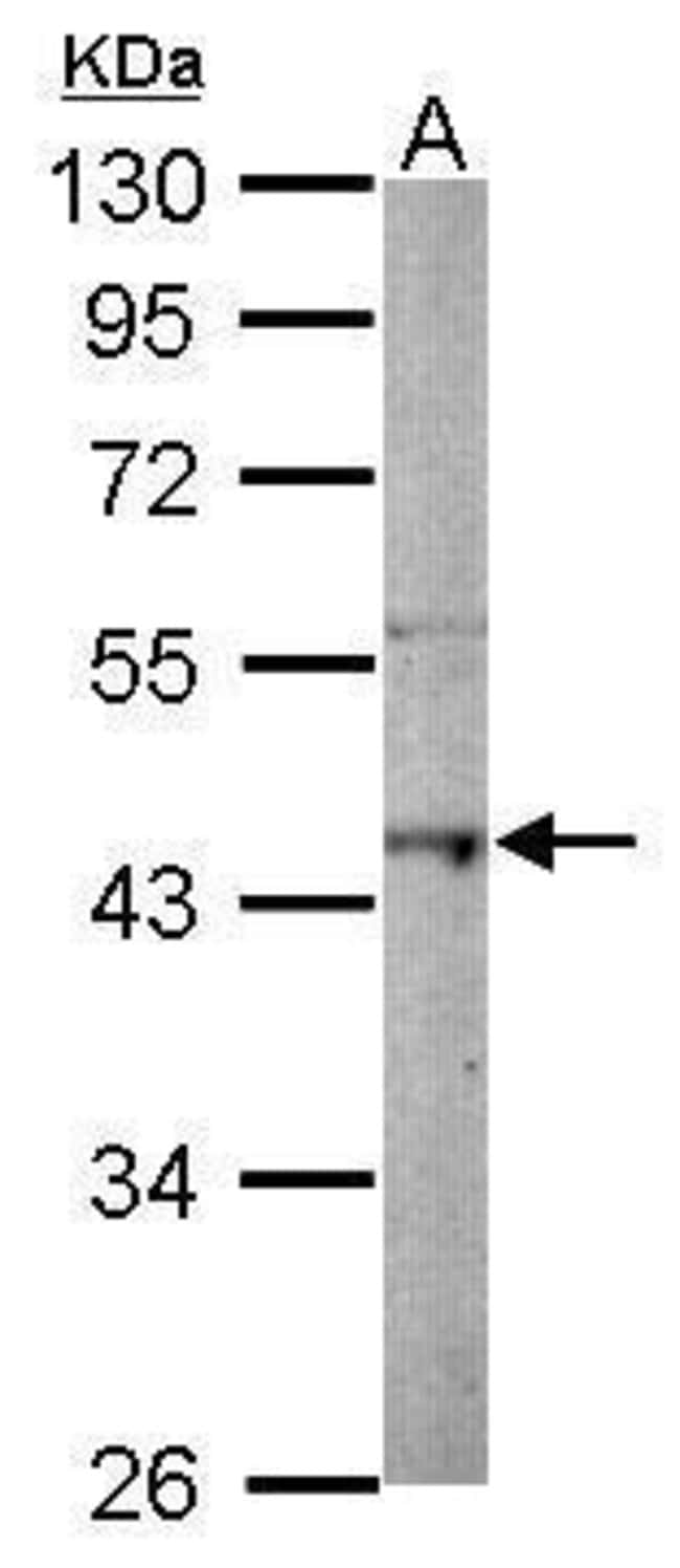 Invitrogen Macro H2A.2 Polyclonal Antibody 100 μL; Unconjugated ...