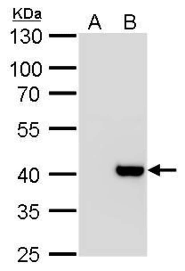 Invitrogen Macro H2A.2 Polyclonal Antibody 100 μL; Unconjugated ...