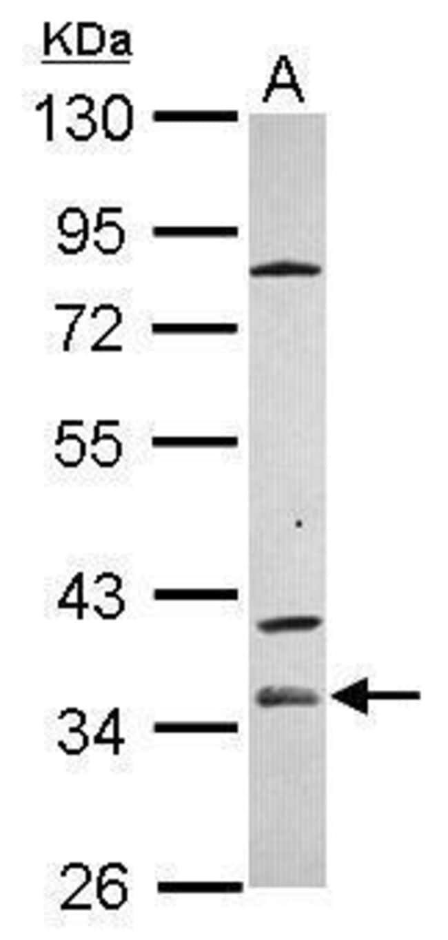 Invitrogen ZP1 Polyclonal Antibody 100 μL; Unconjugated:Antibodies ...