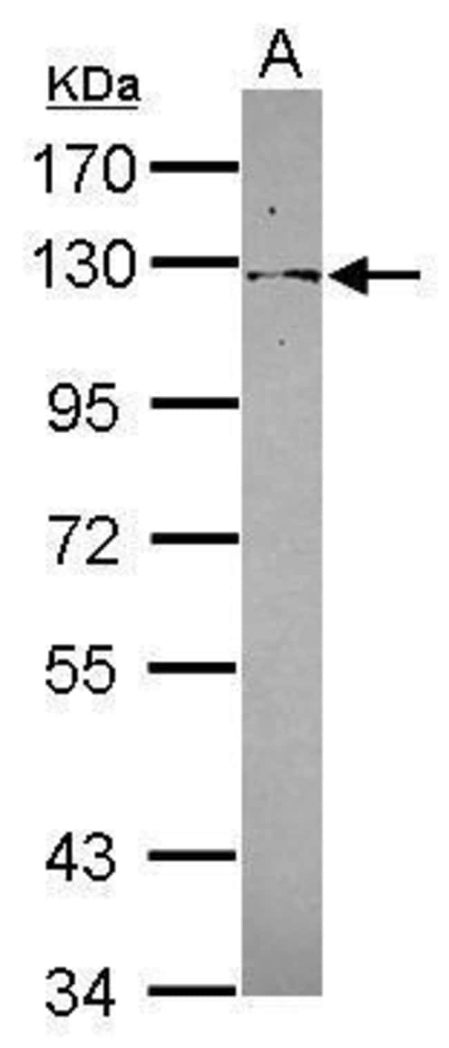 Invitrogen PSD4 Polyclonal Antibody 100 μL; Unconjugated:Antibodies ...