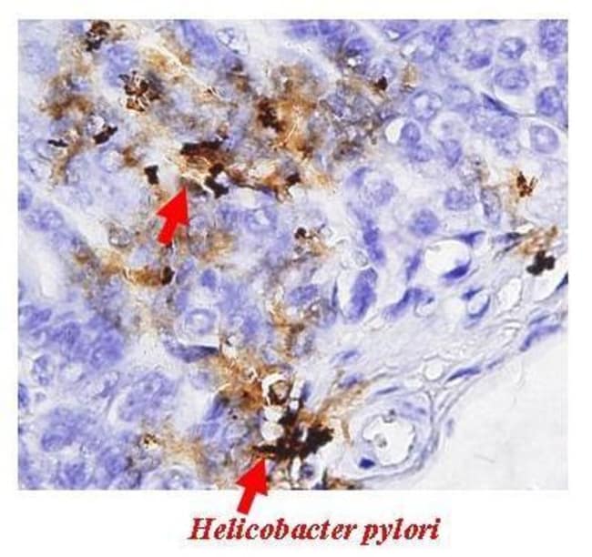 Invitrogen Helicobacter pylori Urease B Polyclonal Antibody 100 μL ...