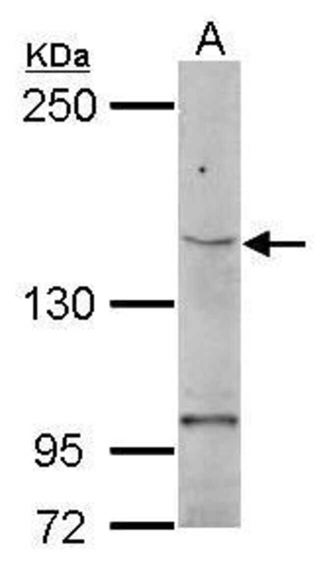 Invitrogen TERT Polyclonal Antibody 100 μL; Unconjugated:Anticorps ...