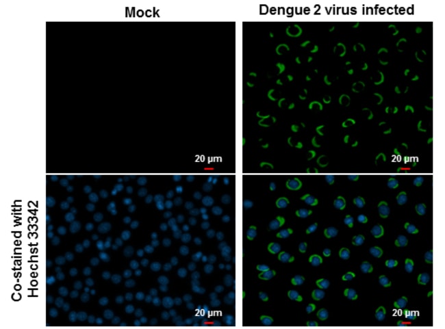 Invitrogen Dengue Virus Type 2 NS1 Polyclonal Antibody 100 μL ...