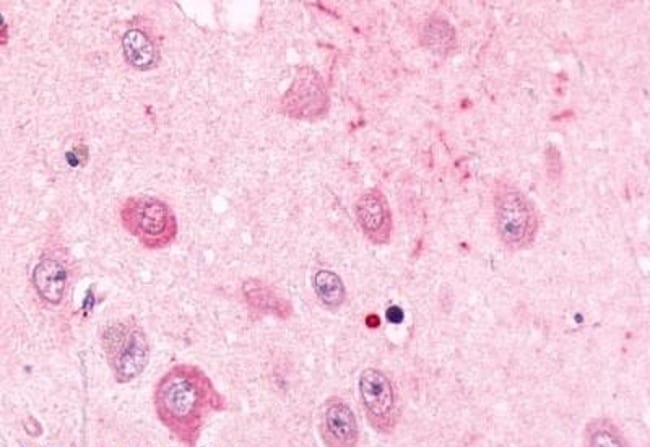 Invitrogen alpha-2c Adrenergic Receptor Polyclonal Antibody 50 μg ...