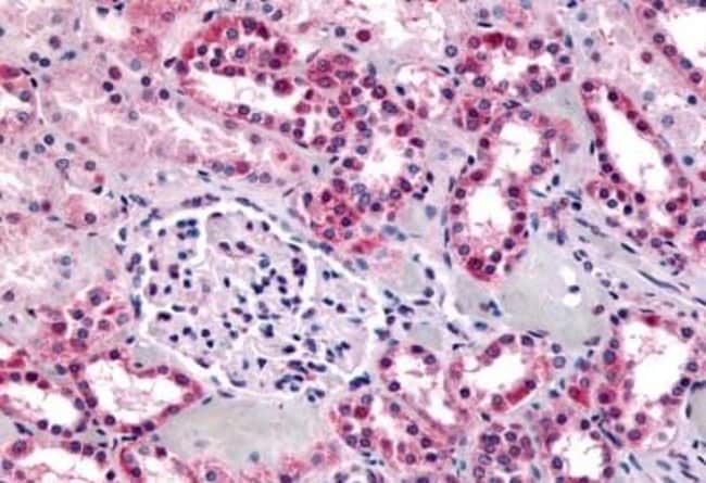 Invitrogen GPR91 Polyclonal Antibody 50 μg; Unconjugated:Antikörper ...