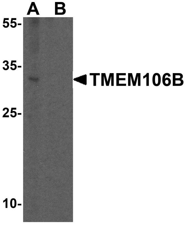 Invitrogen TMEM106B Polyclonal Antibody 100 μg; Unconjugated ...