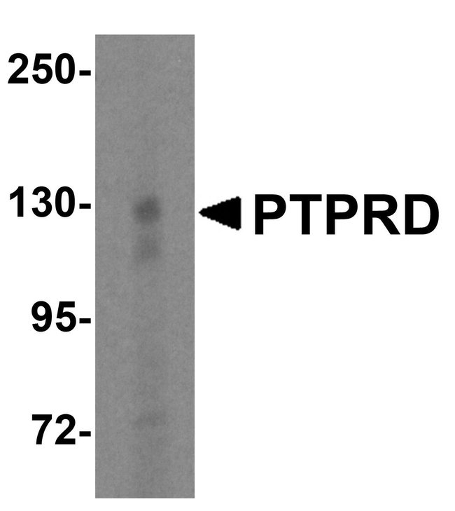 PTPRD Polyclonal Antibody, Invitrogen 100 μg; Unconjugated:Antibodies ...