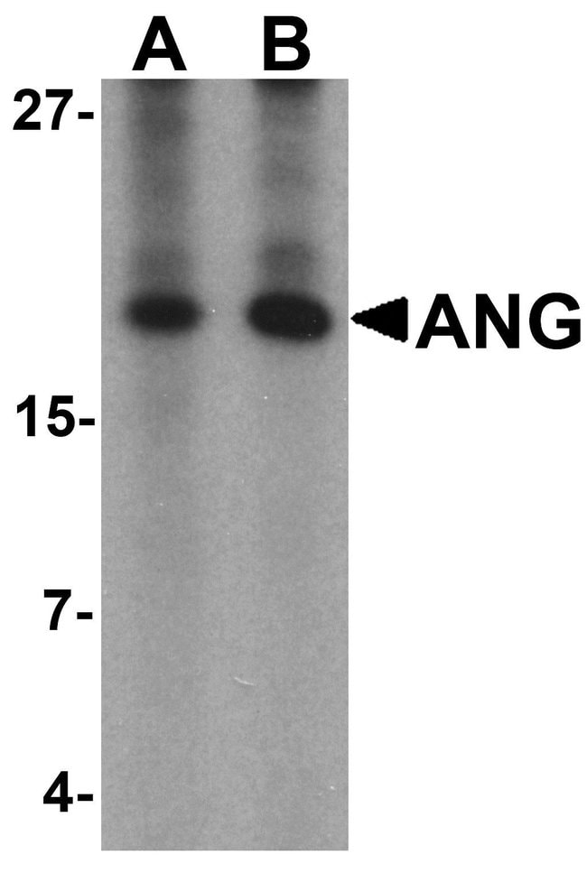 Invitrogen Angiogenin Polyclonal Antibody 100 μg; Unconjugated ...