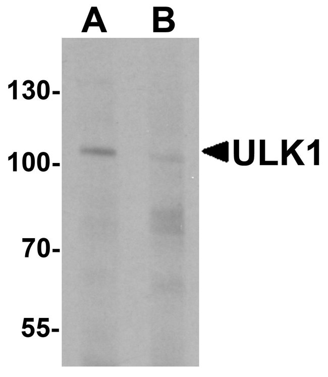 ULK1 Polyclonal Antibody, Invitrogen 100 μg; Unconjugated:Anticuerpos ...