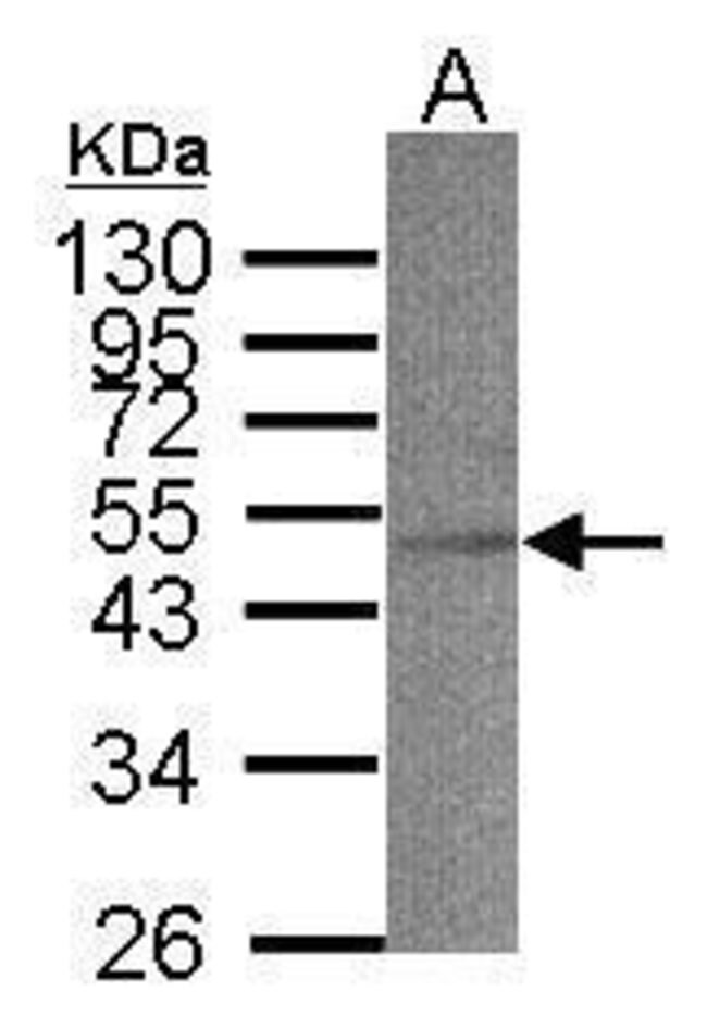 ACADS Polyclonal Antibody, Invitrogen 100 μL; Unconjugated:Antibodies ...