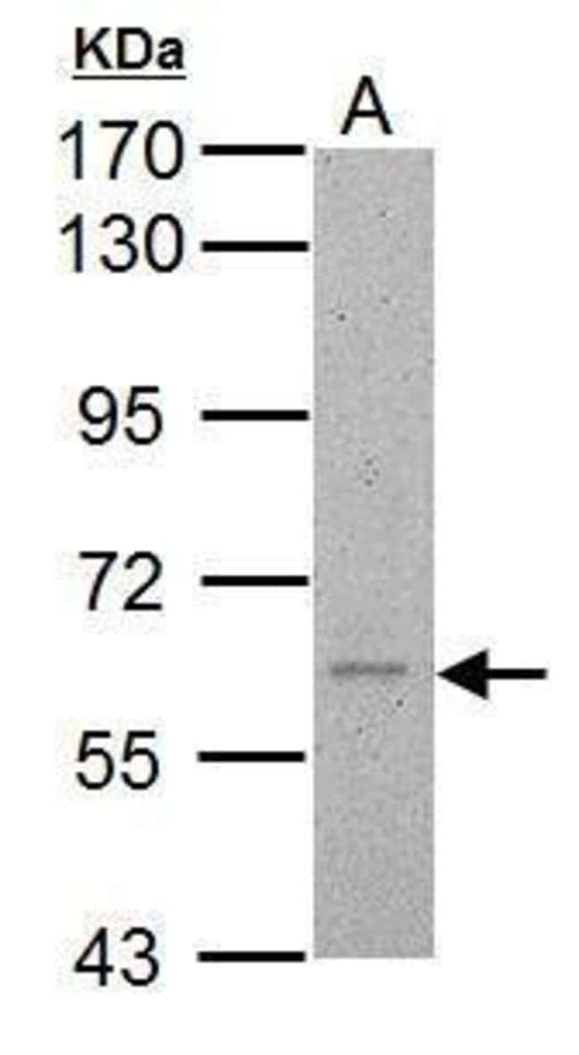 Invitrogen Calcium Channel beta-4 Polyclonal Antibody 100 μL ...
