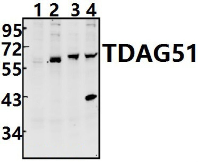 Invitrogen PHLDA1 Polyclonal Antibody 100 μL | Buy Online | Invitrogen ...