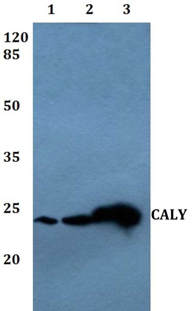 Invitrogen CALY Polyclonal Antibody 100 μL; Unconjugated:Antibodies ...