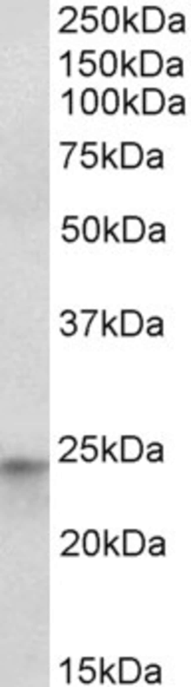 HES4 Polyclonal Antibody, Invitrogen 100 μg; Unconjugated:Anticuerpos ...