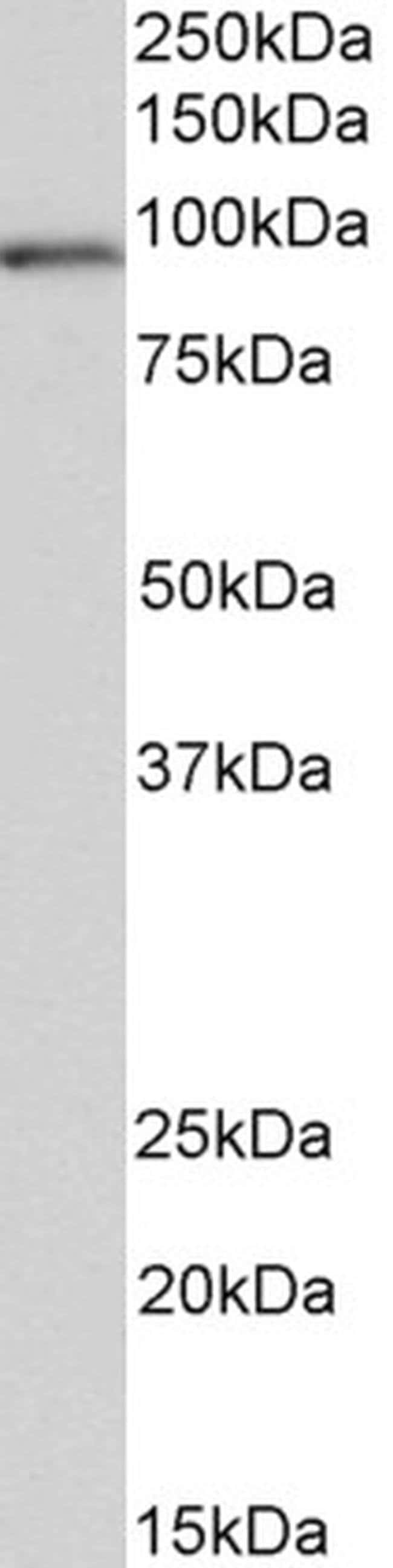 VPS16 Polyclonal Antibody, Invitrogen™ 100 μg; Unconjugated Ver ...