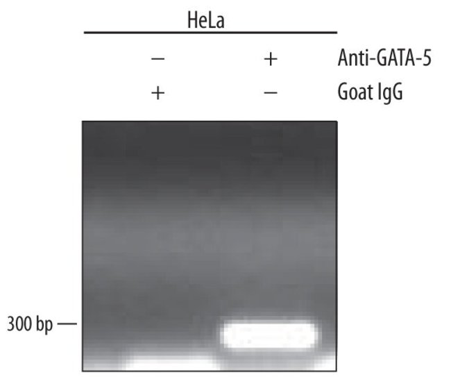 Invitrogen GATA5 Polyclonal Antibody 100 μg; Unconjugated:Antibodies ...