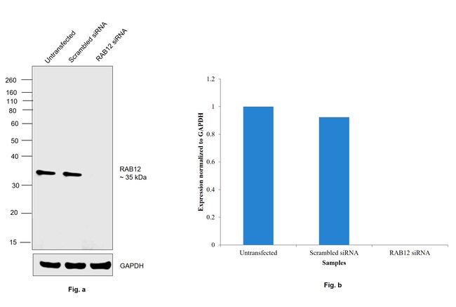 RAB12 Polyclonal Antibody, Invitrogen 400 μL; Unconjugated:Antibodies ...
