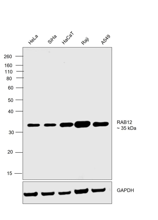 RAB12 Polyclonal Antibody, Invitrogen 400 μL; Unconjugated:Antibodies ...