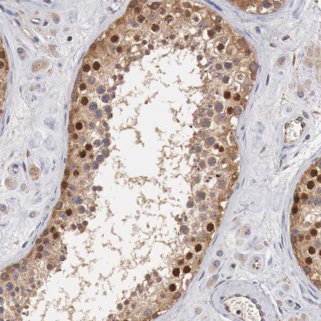 Invitrogen Cyclin B3 Polyclonal Antibody 100 μL; Unconjugated:Anticorps ...