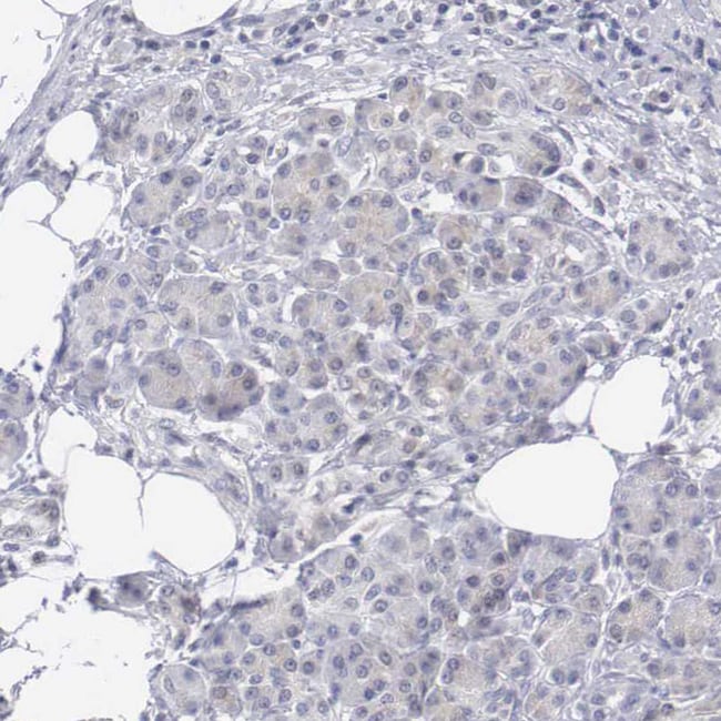 Invitrogen MNAT1 Polyclonal Antibody 100 μL | Buy Online | Invitrogen ...