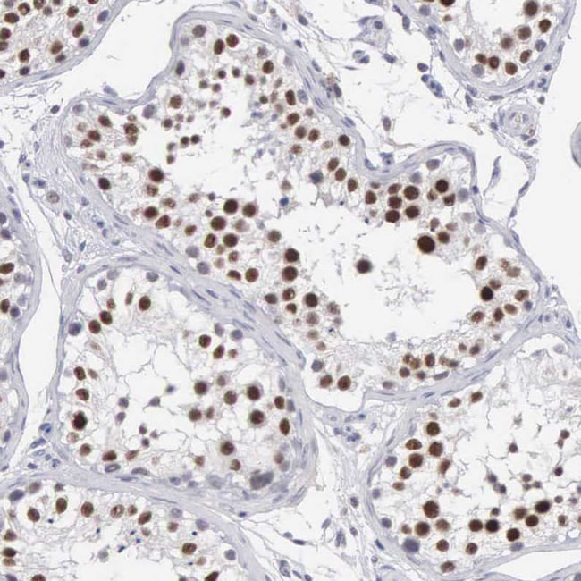 Invitrogen MNAT1 Polyclonal Antibody 100 μL | Buy Online | Invitrogen ...