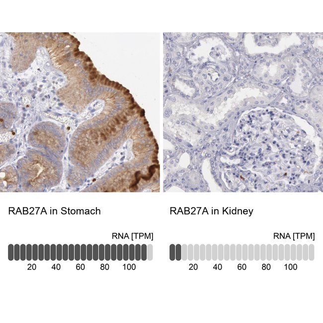 RAB27A Polyclonal Antibody, Invitrogen 100 μL; Unconjugated:Antibodies ...