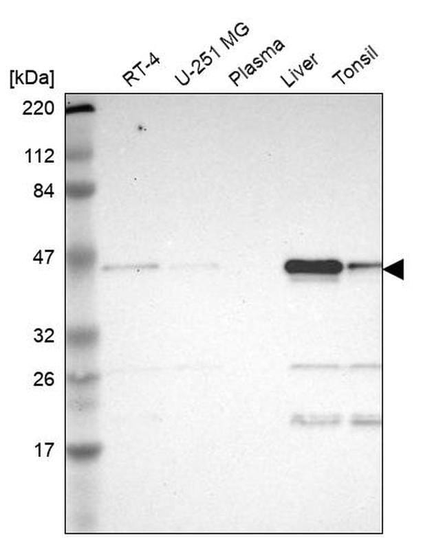 Calumenin Polyclonal Antibody, Invitrogen 100 μL; Unconjugated ...