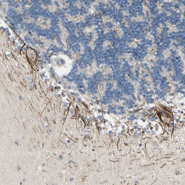 Invitrogen ABCA3 Polyclonal Antibody 100 μL; Unconjugated:Antikroppar ...