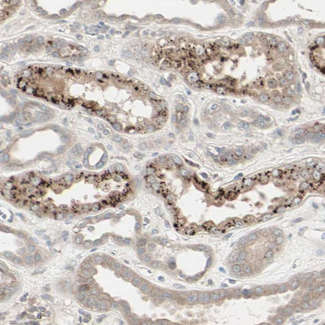 Invitrogen CALCRL Polyclonal Antibody 100 μL; Unconjugated:Antibodies ...