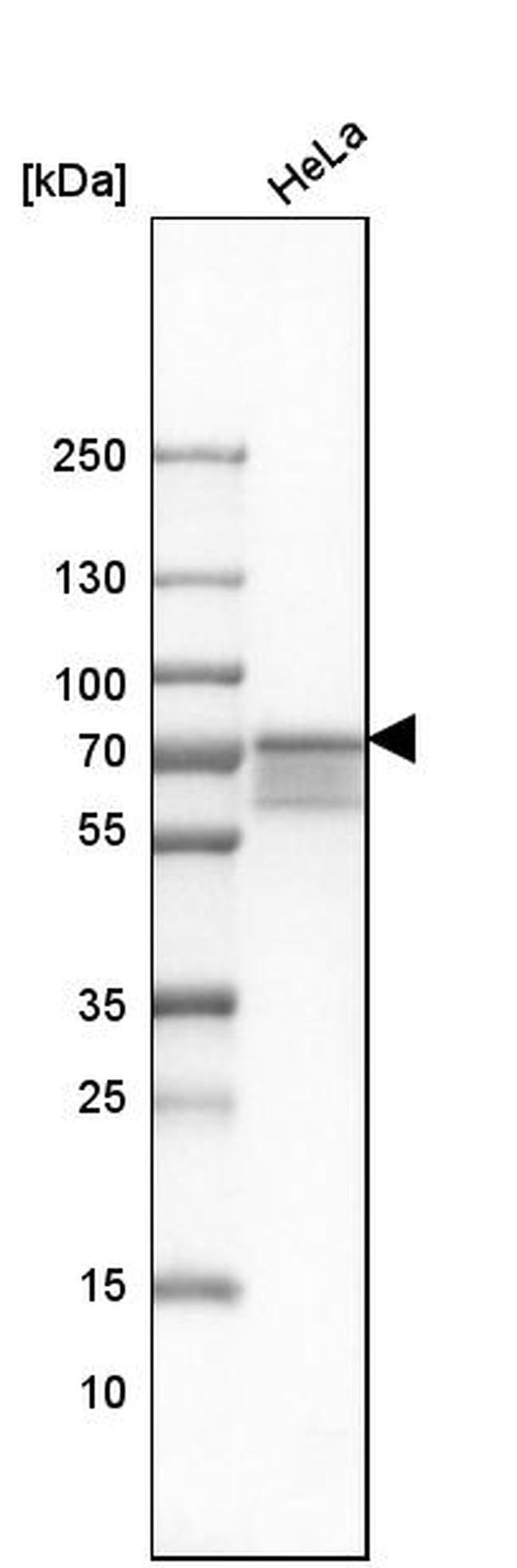 FUS Polyclonal Antibody, Invitrogen 100 μL; Unconjugated:Antikörper ...