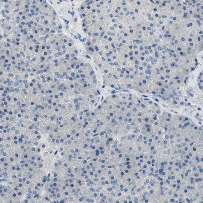 Neurofascin Polyclonal Antibody, Invitrogen 100 μL; Unconjugated ...